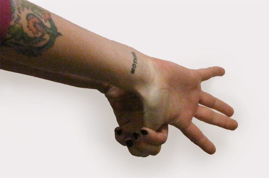 How to Cure Knitting Hand Pain - One Exercise for Instant Relief